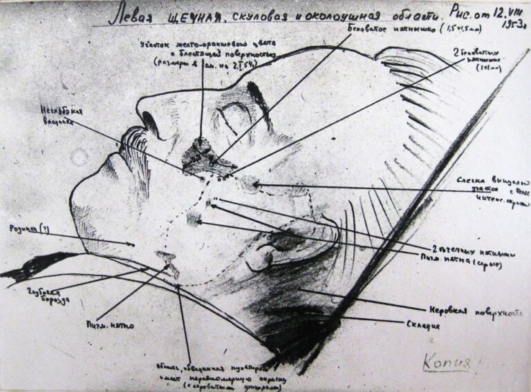 Embalming Techniques for Long-Term Preservation of Bodies - The Journal ...