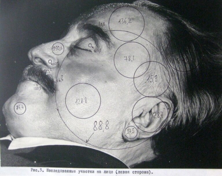 Embalming Techniques for Long-Term Preservation of Bodies - The Journal ...