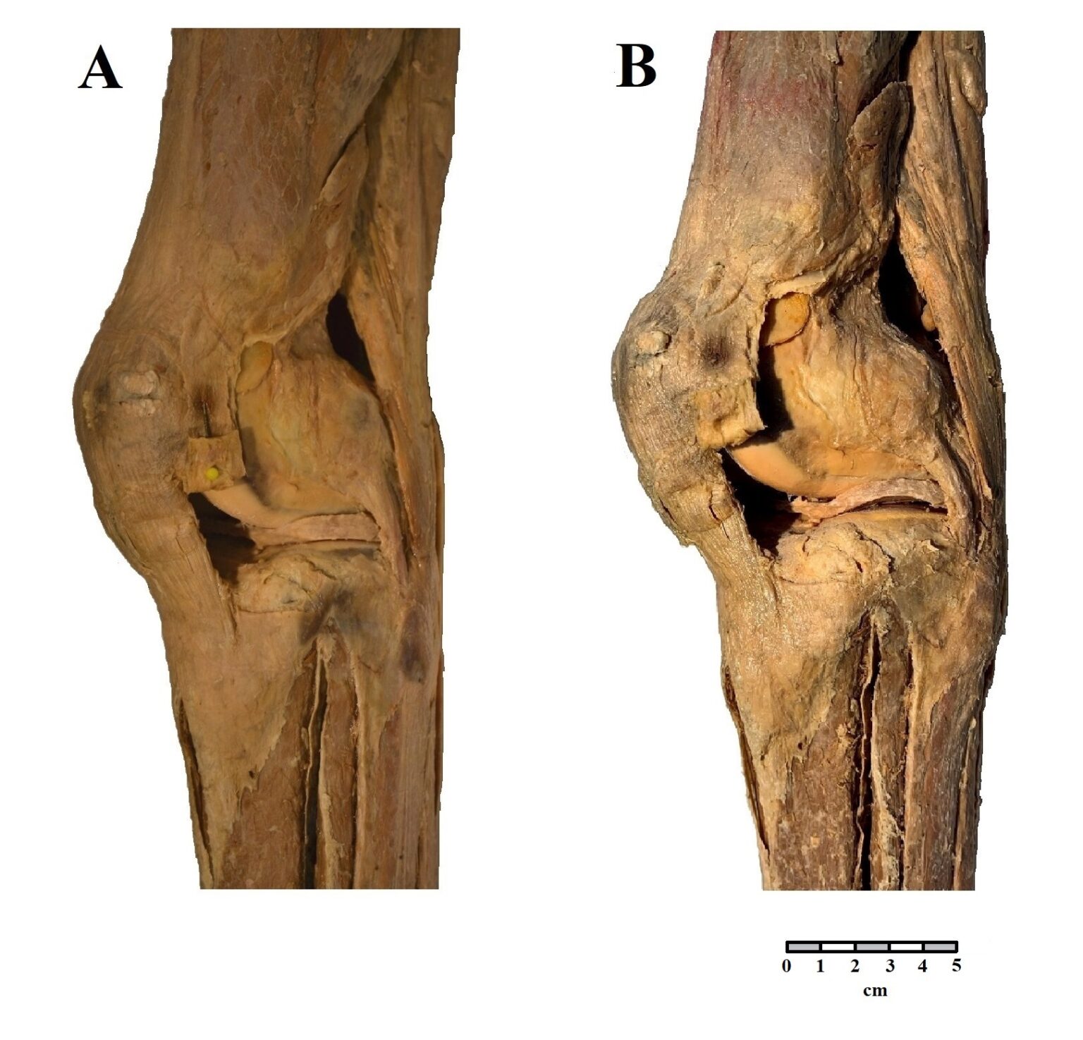 Plastination of glycerin-fixed specimens - The Journal of Plastination