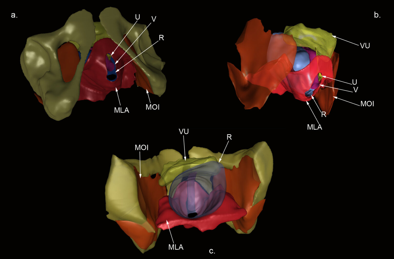 Three dimensional reconstruction of a female pelvis using plastinated ...