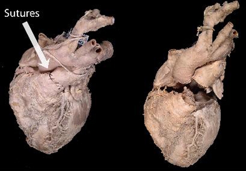 Demonstration of Systolic and Diastolic Phases of the Cardiac Cycle in ...