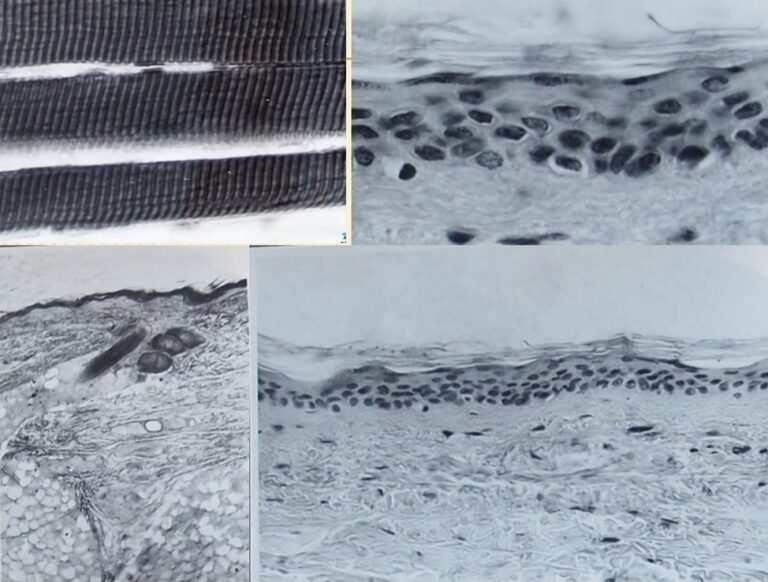 Embalming Techniques for Long-Term Preservation of Bodies - The Journal ...