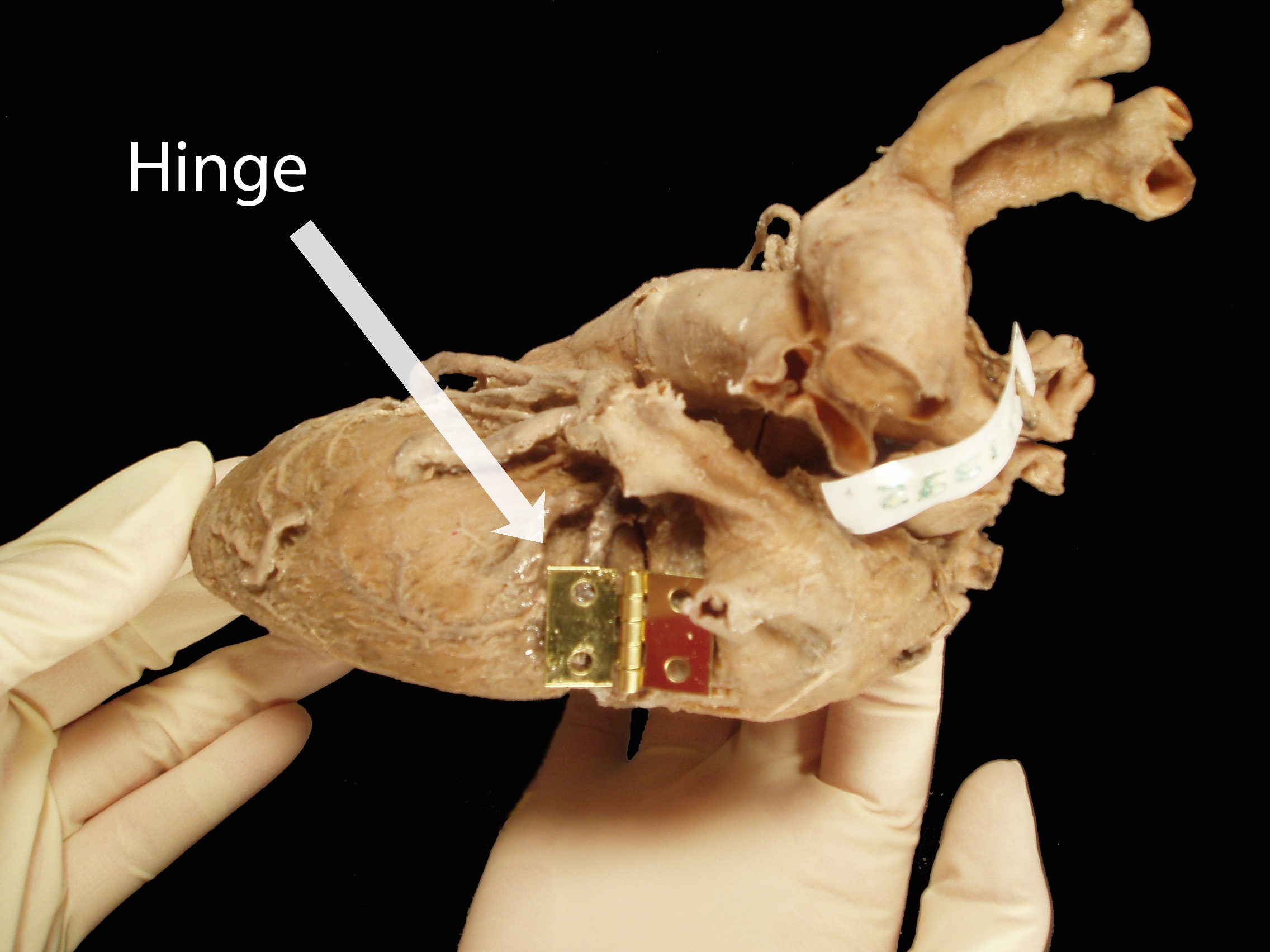 Demonstration of Systolic and Diastolic Phases of the Cardiac Cycle in ...