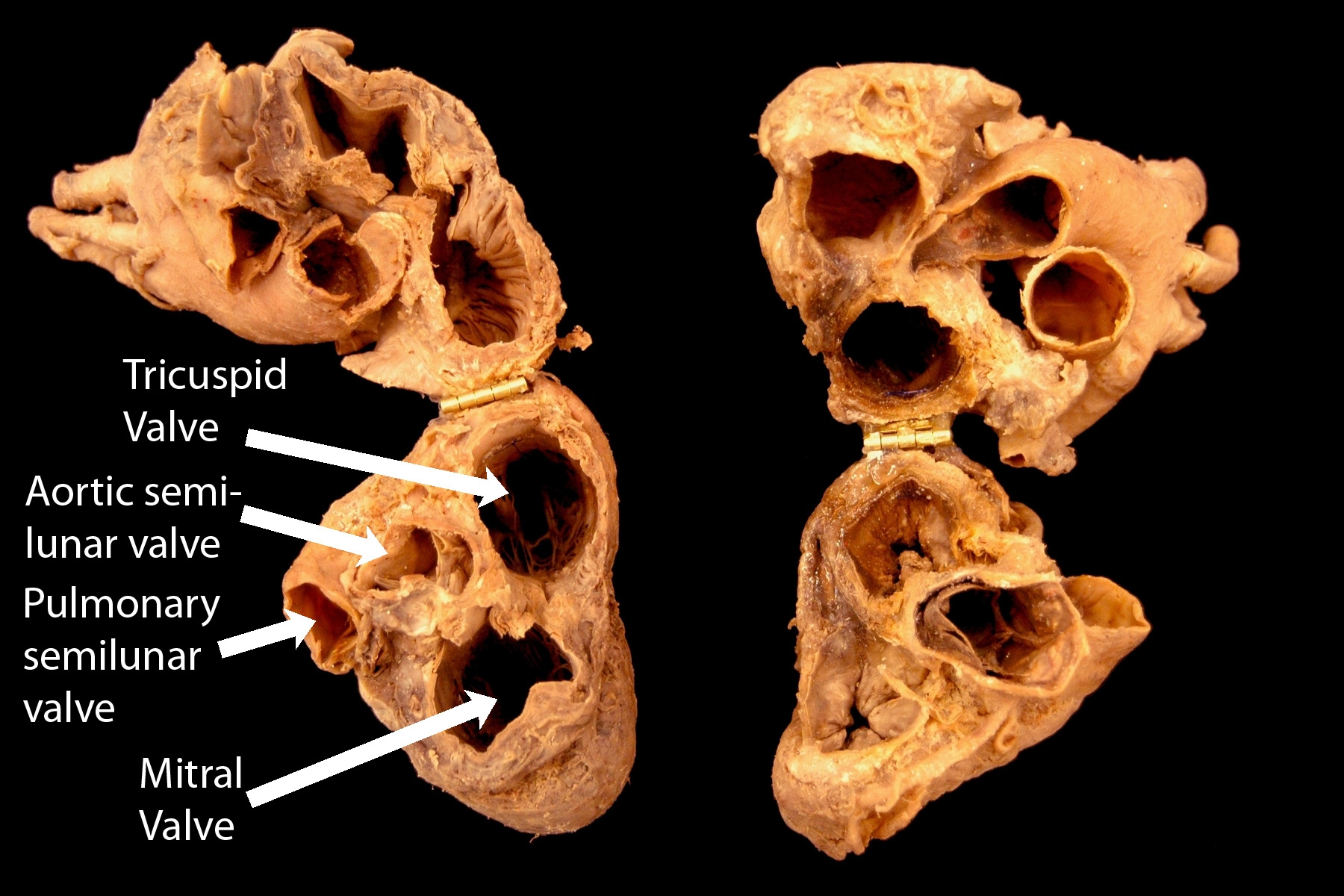 Demonstration of Systolic and Diastolic Phases of the Cardiac Cycle in ...