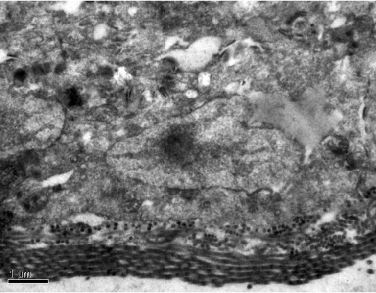 Embalming Techniques for Long-Term Preservation of Bodies - The Journal ...