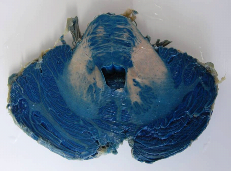 Low-temperature dehydration and room-temperature impregnation of brain ...