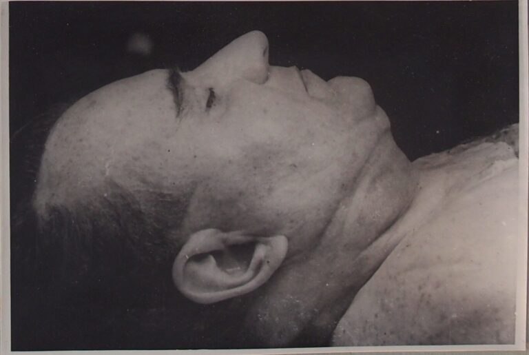 Embalming Techniques for Long-Term Preservation of Bodies - The Journal ...