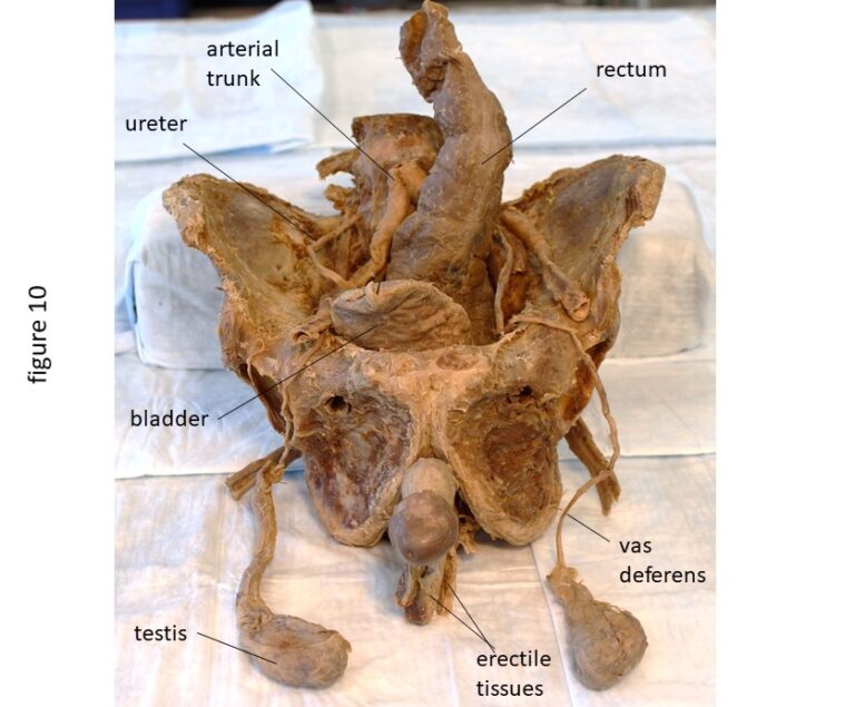 Method for Creating Interactive Plastinated Models of the Male and ...