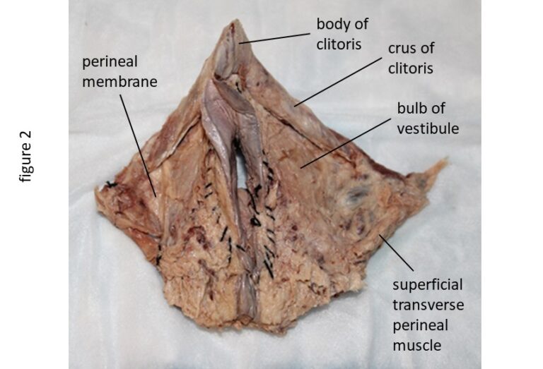 Method for Creating Interactive Plastinated Models of the Male and ...