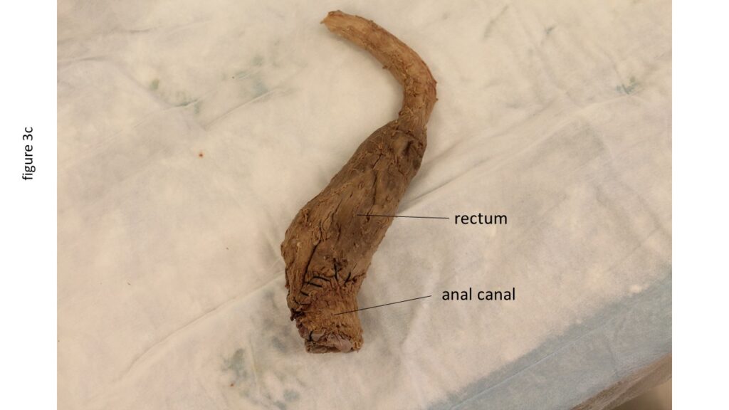 Method for Creating Interactive Plastinated Models of the Male and ...