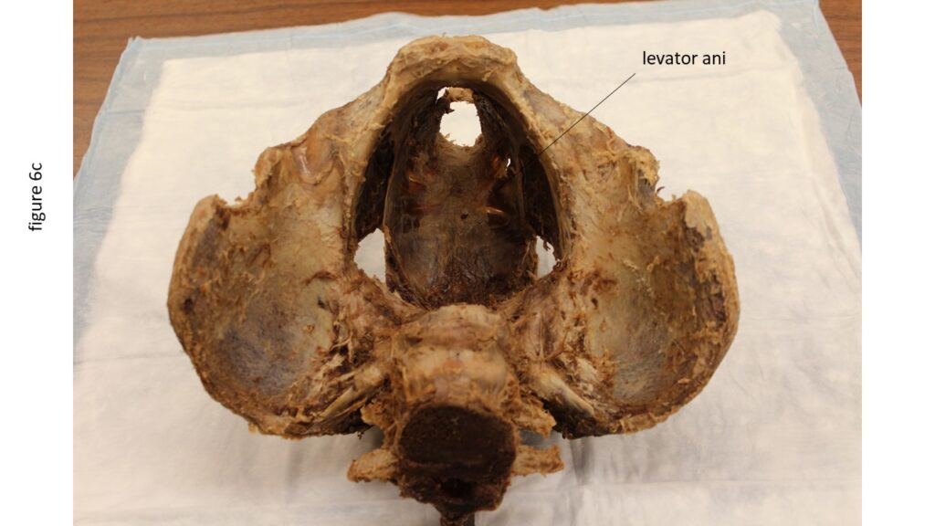 Method for Creating Interactive Plastinated Models of the Male and ...
