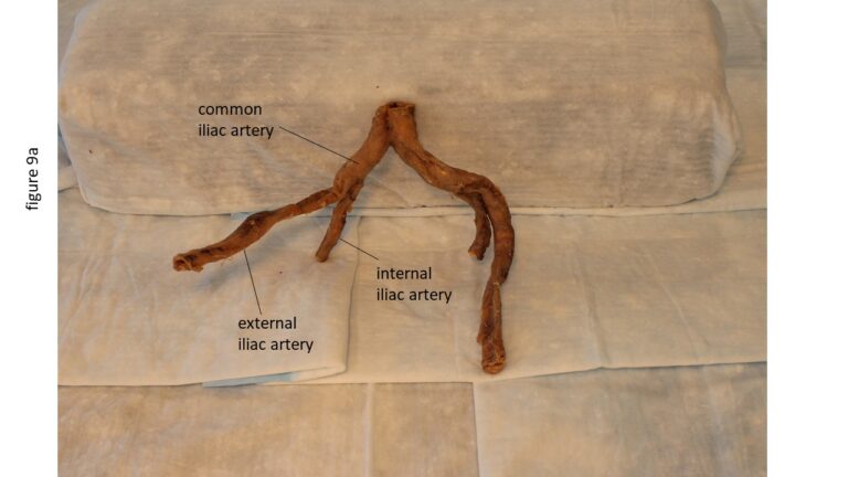Method for Creating Interactive Plastinated Models of the Male and ...