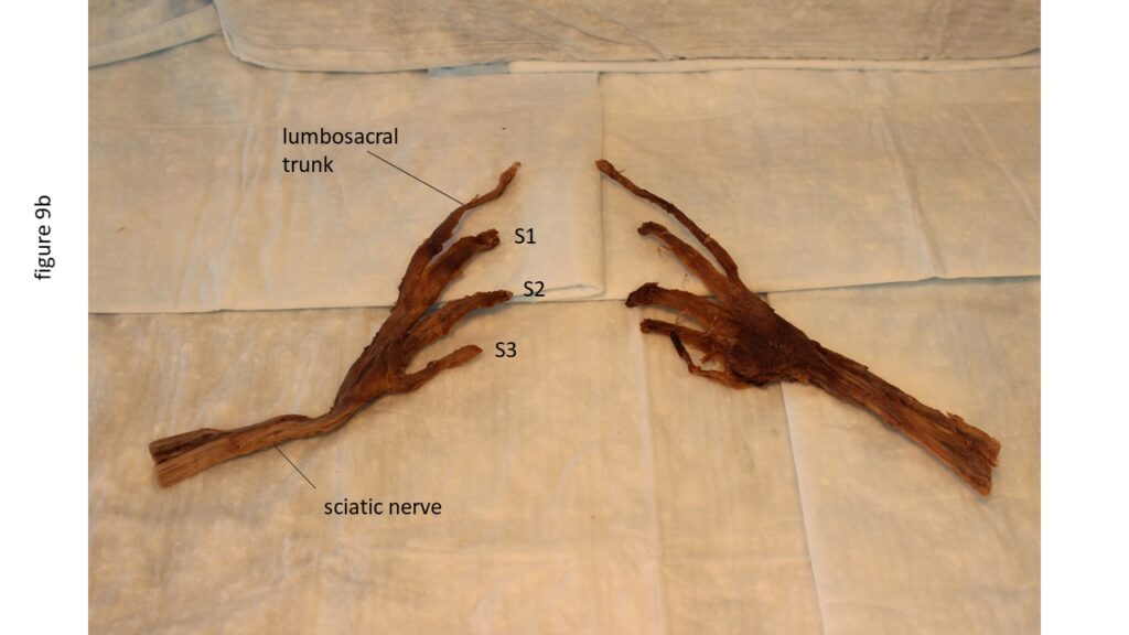 Method for Creating Interactive Plastinated Models of the Male and ...