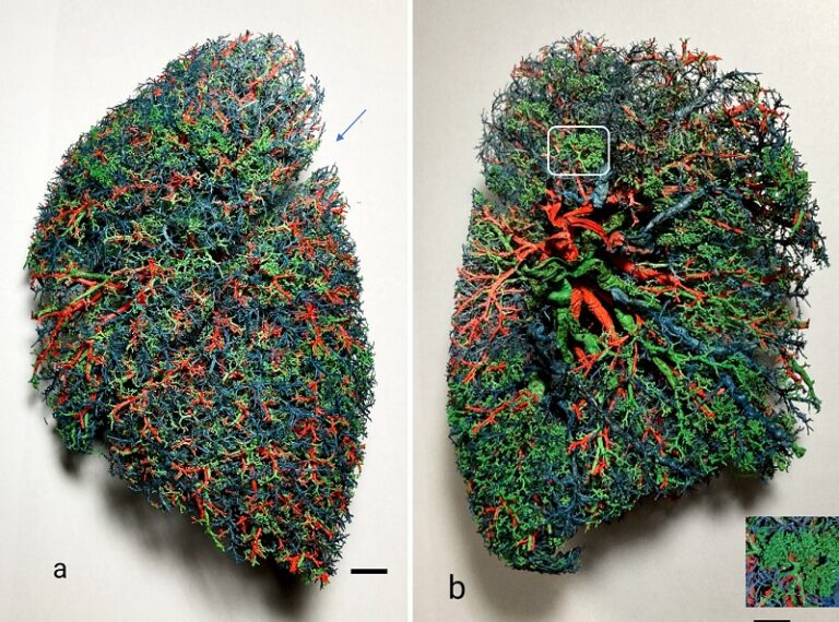 Preparation of three-dimensional corrosion casts of the bronchovascular ...