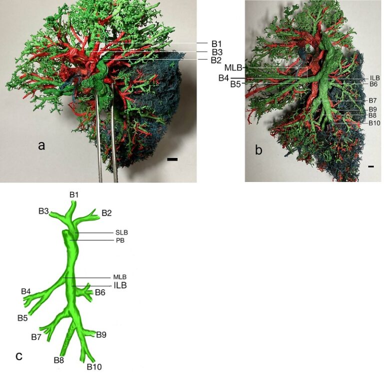Preparation of three-dimensional corrosion casts of the bronchovascular ...