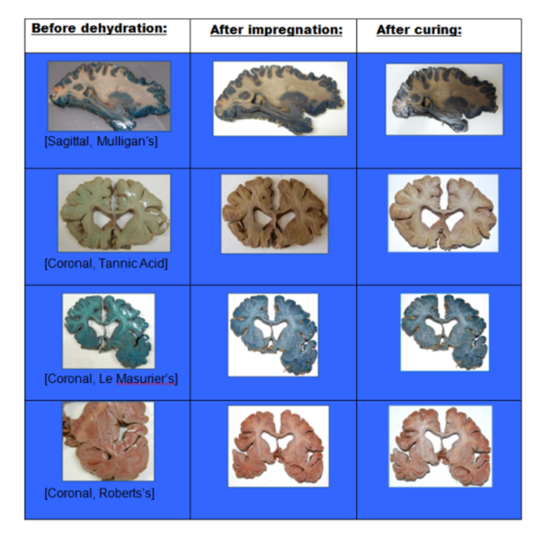 Comparative Staining Methods With Room Temperature Plastination (15 ...