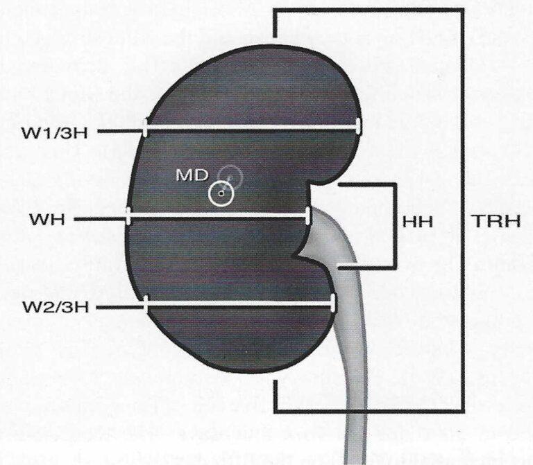 Computerized Reconstruction of a Plastinated Human Kidney Using Serial ...