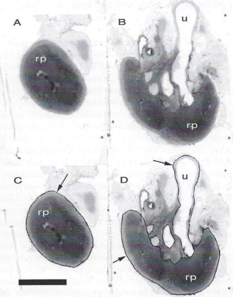 Computerized Reconstruction of a Plastinated Human Kidney Using Serial ...