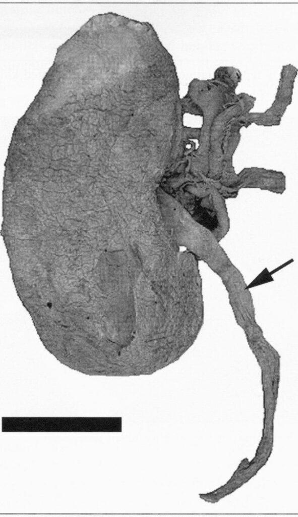 Computerized Reconstruction of a Plastinated Human Kidney Using Serial ...