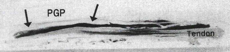 Anatomy of Synovial Sheaths in the Talocrural Region Evaluated by Sheet ...