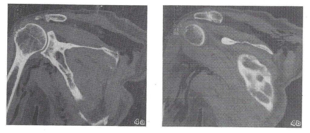 A New Positioning Technique for Comparing Sectional Anatomy of the ...