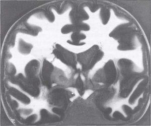 Preparing and Using S-10 and P-35 Brain Slices - The Journal of ...