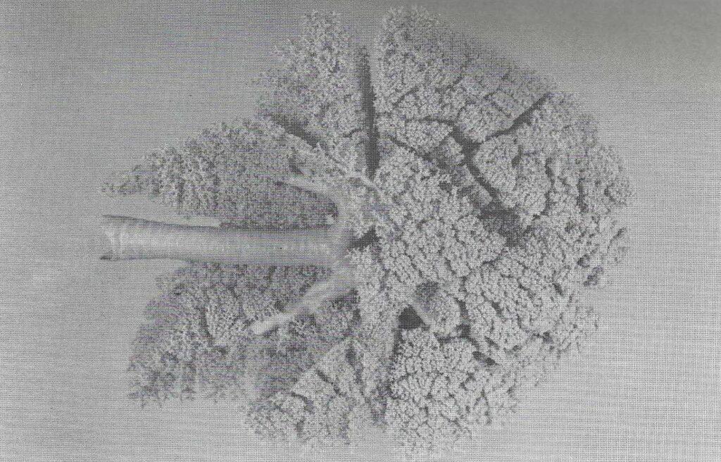 Silicone Tracheobronchial Casts - The Journal of Plastination