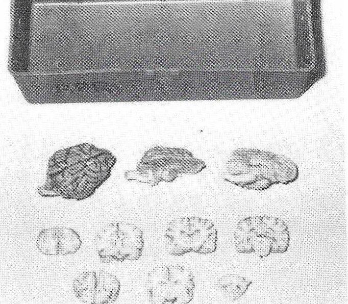Use of Plastinated Brains in Teaching Neuroanatomy at the North ...