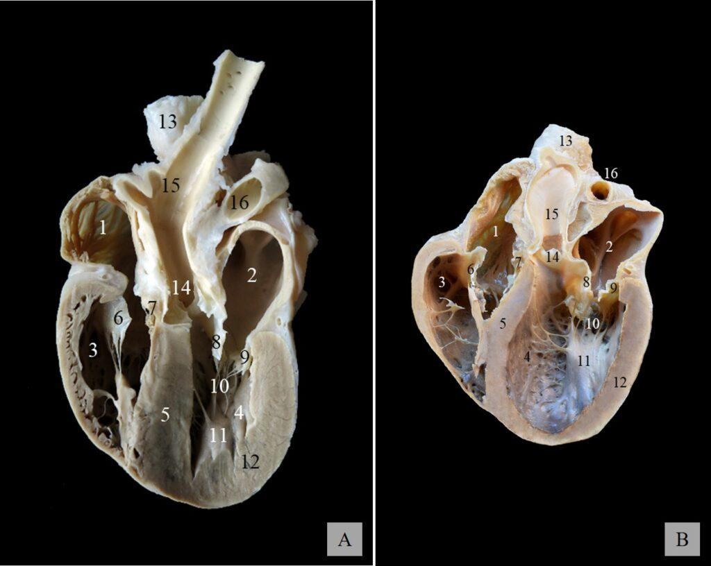 A digital resource based on plastinated specimens for learning dilated ...