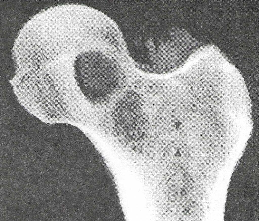 The Diagnostic Imaging Characteristics of Plastinated Anatomical ...