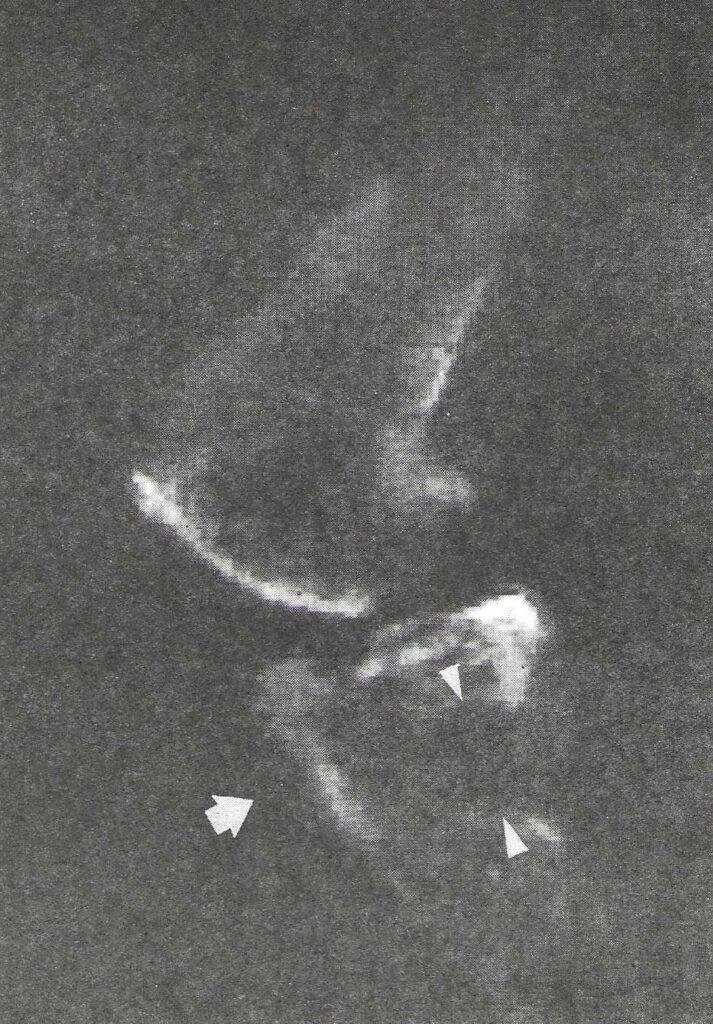 The Diagnostic Imaging Characteristics of Plastinated Anatomical ...