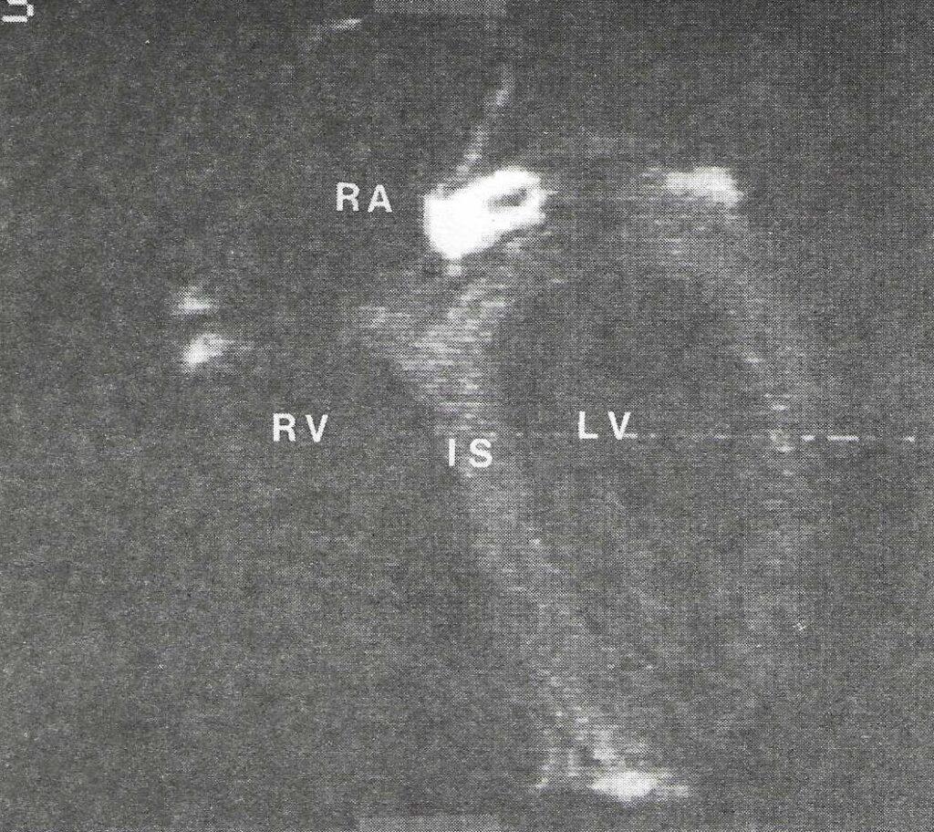 The Diagnostic Imaging Characteristics of Plastinated Anatomical ...