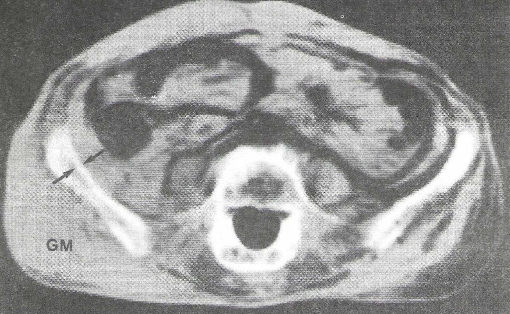 The Diagnostic Imaging Characteristics of Plastinated Anatomical ...