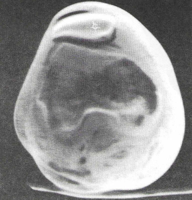 The Diagnostic Imaging Characteristics of Plastinated Anatomical ...