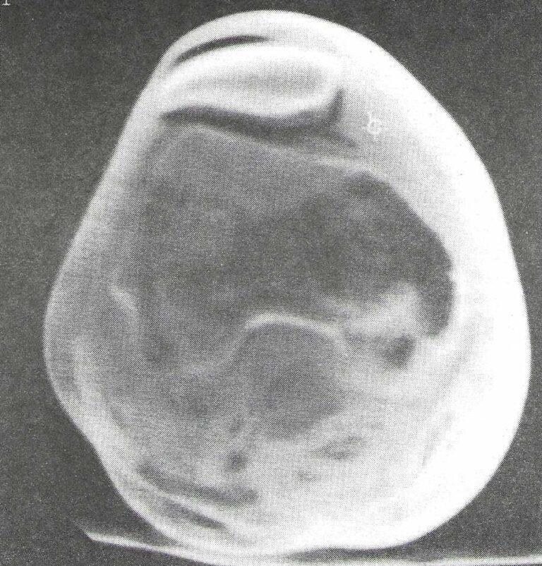 The Diagnostic Imaging Characteristics of Plastinated Anatomical ...