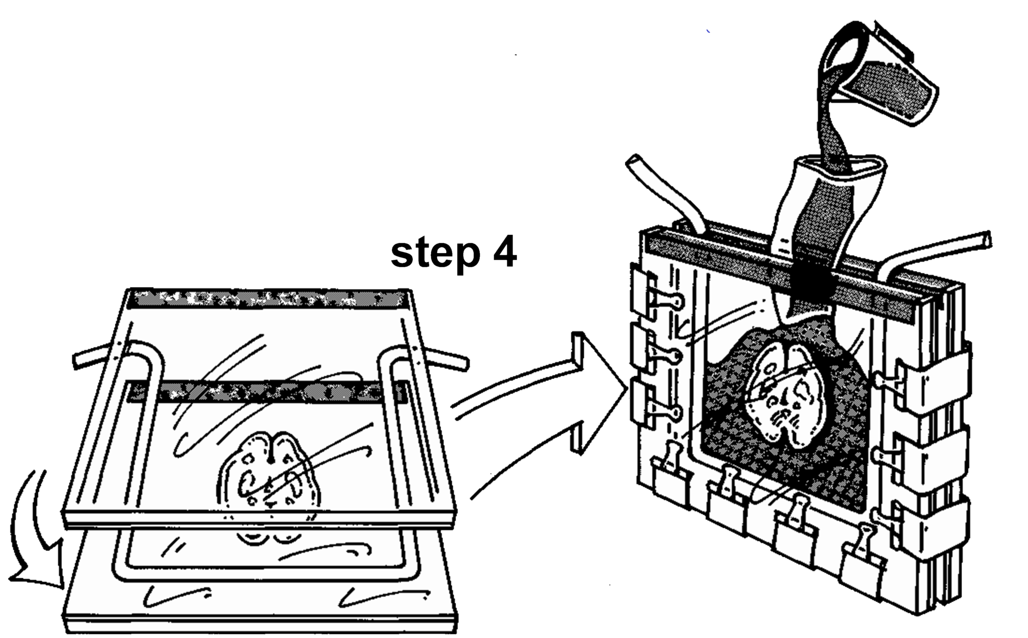 Sheet Plastination of The Brain - P 35 Technique, Filling Method - The ...