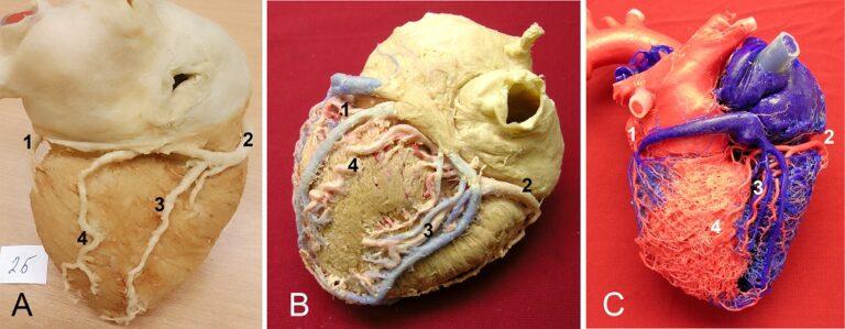 Features of the study of coronary arteries in silicone-plastinated ...